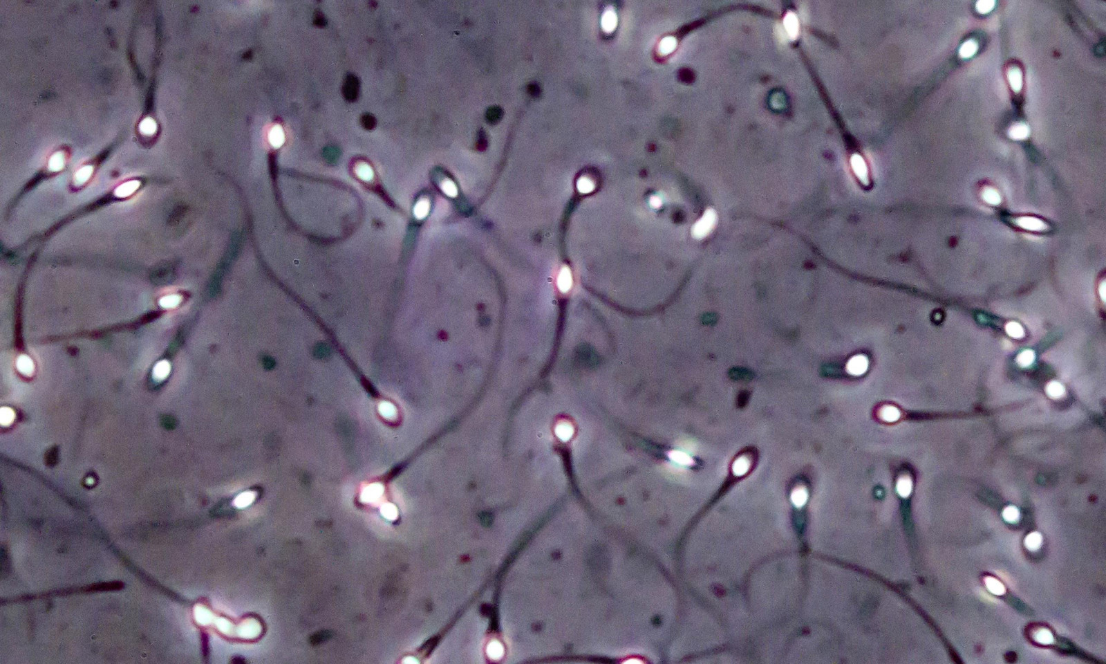 배경 화면 : 1sperm, 2560x1536 px, 추상, 추출, 보케, 세포, DNA, 계란, 달걀, 생명, 남성, 남자 ...
